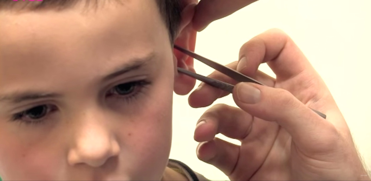 11 Of The Strangest And Grossest Things Doctors Have Found Inside Their ...