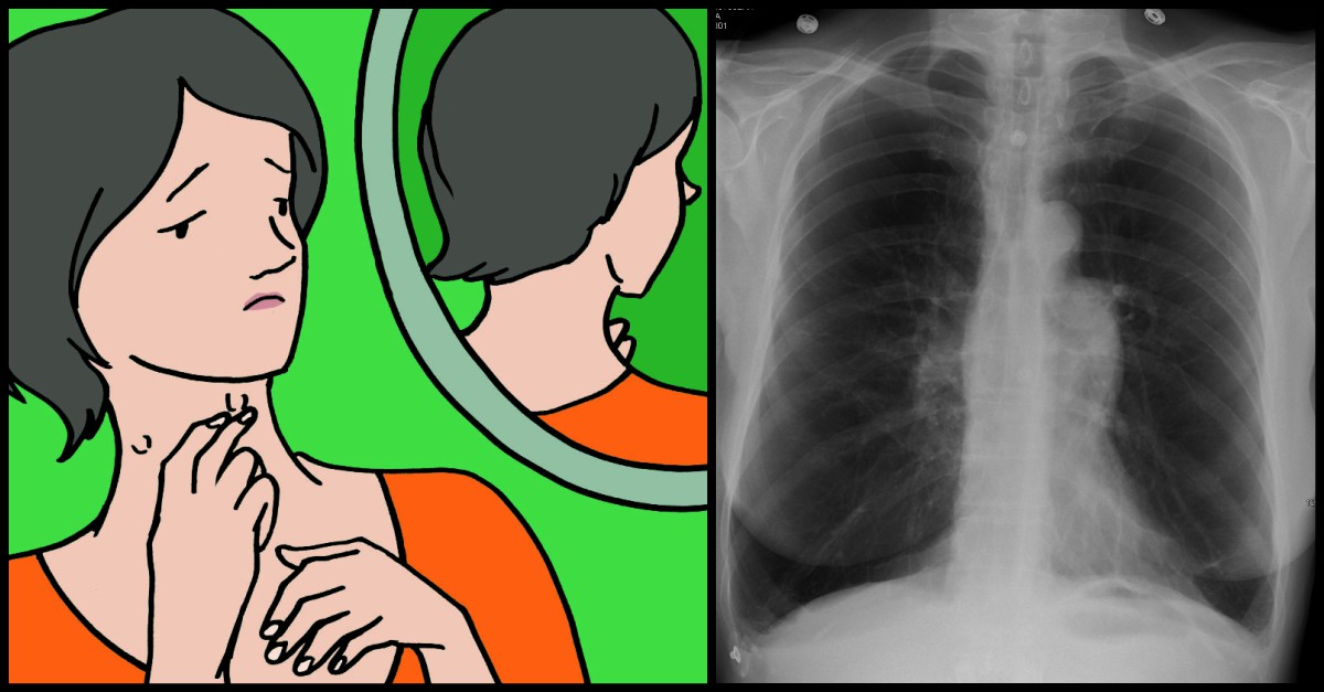 7 Invisible Skin Cancer Signs Everyone Should Know About | LittleThings.com