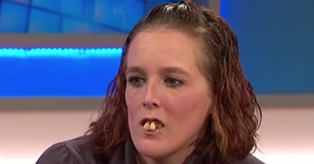 Bullies Called Her 'Tooth Lady,' Then She Gets New Teeth And Totally ...