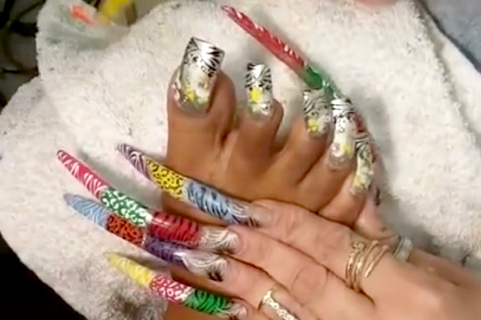 These Extra Long Toenails Are Quite the Sight To See | LittleThings.com