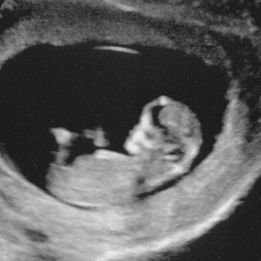Do Babies Pee In The Womb 10 Weird Things That Happen LittleThings do-babies-pee-in-the-womb-10-weird-things-that-happen-littlethings