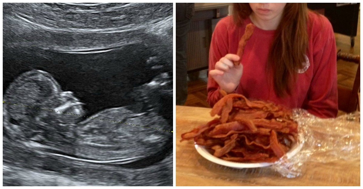 10 Facts About Bacon You Seriously Never Knew | LittleThings.com