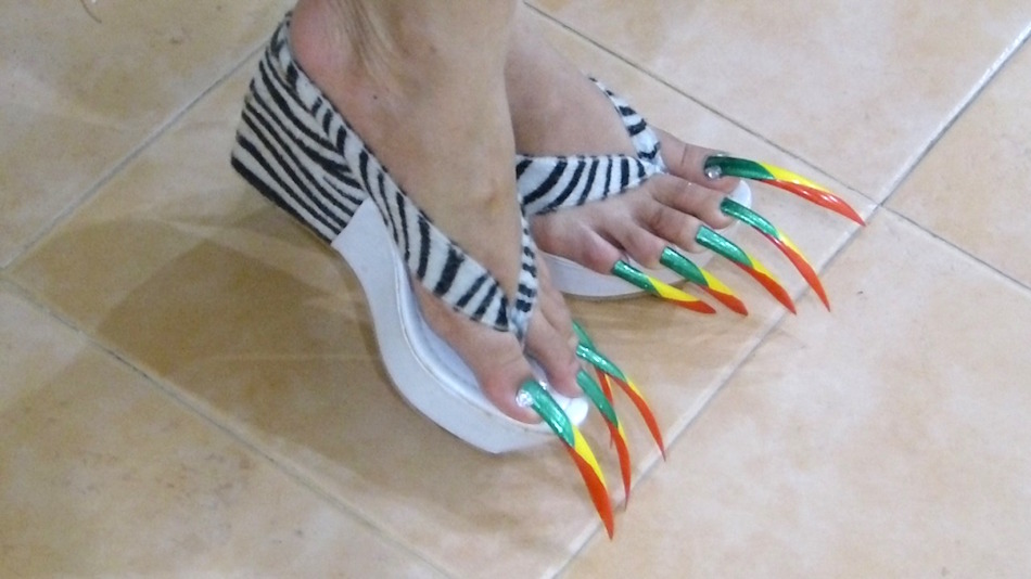 These Extra Long Toenails Are Quite the Sight To See | LittleThings.com