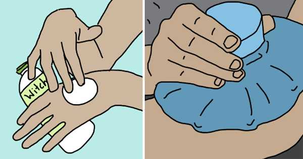 Learn How To Tell And Heal The 5 Different Shades Of Bruises