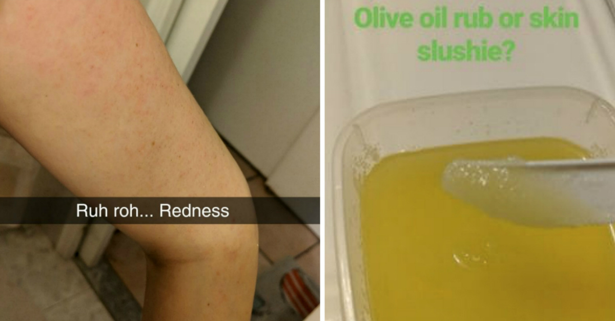 I Tried 5 Different Methods To Cure My 'Chicken Skin' & I Think I'm ...