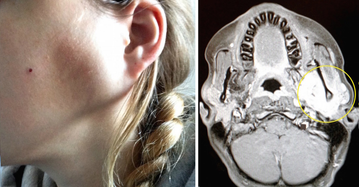 Teen Has Throbbing Bump In Jaw, But Dentist Insists It Has Nothing To ...