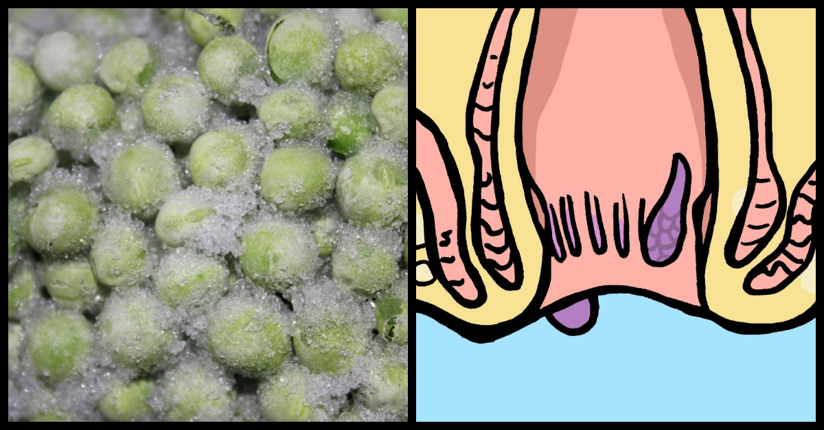 8 Home Remedies For Hemorrhoids To Soothe Pain | LittleThings.com