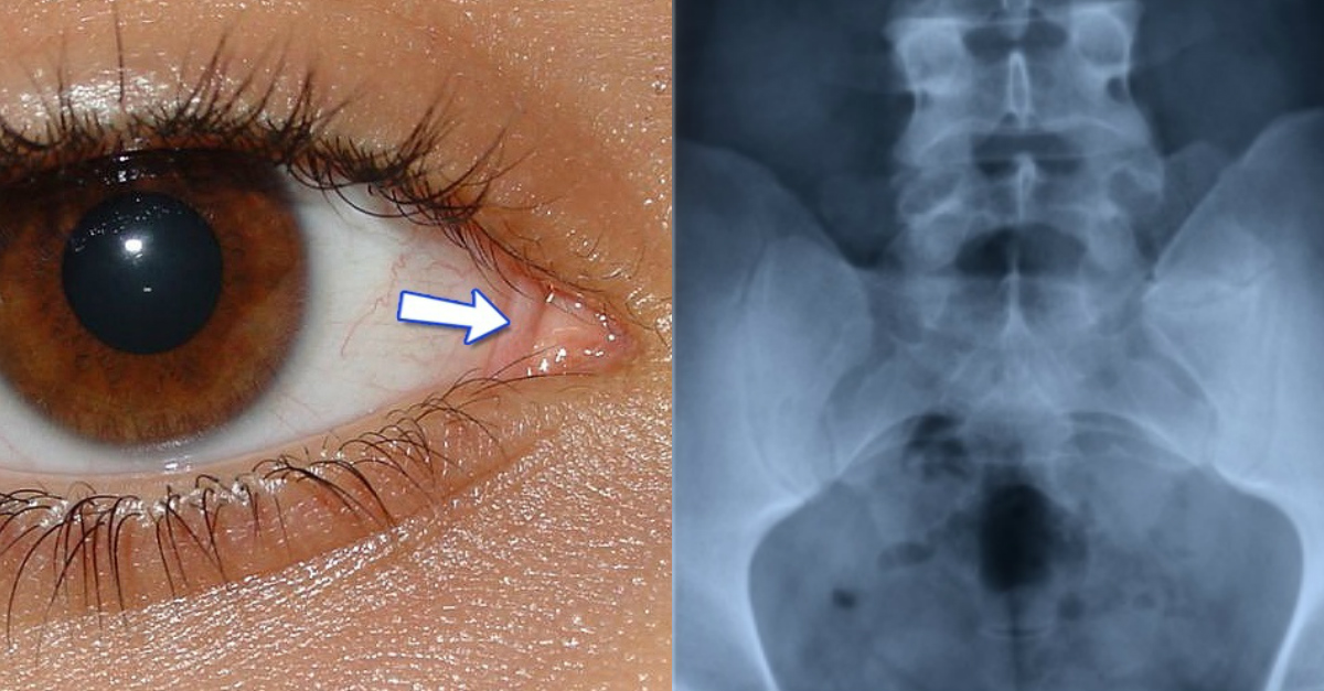 10 Vestigial Traits And Useless Organs—And Why We Still Have Them ...