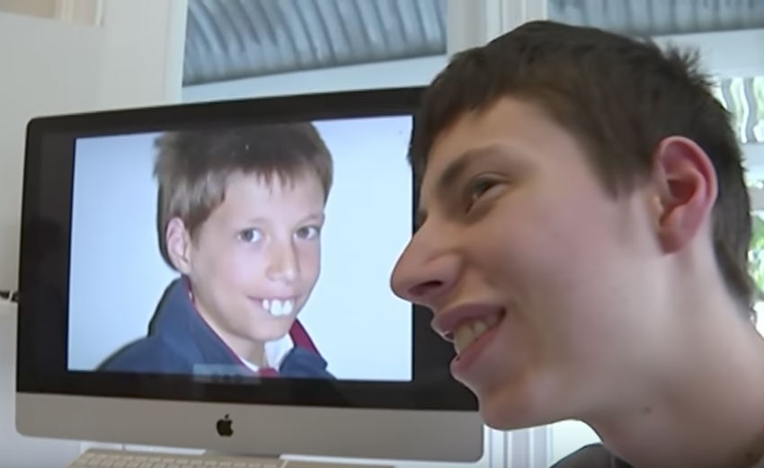 Strangers Help Bullied Boy With Giant Buck Teeth Get New Smile ...
