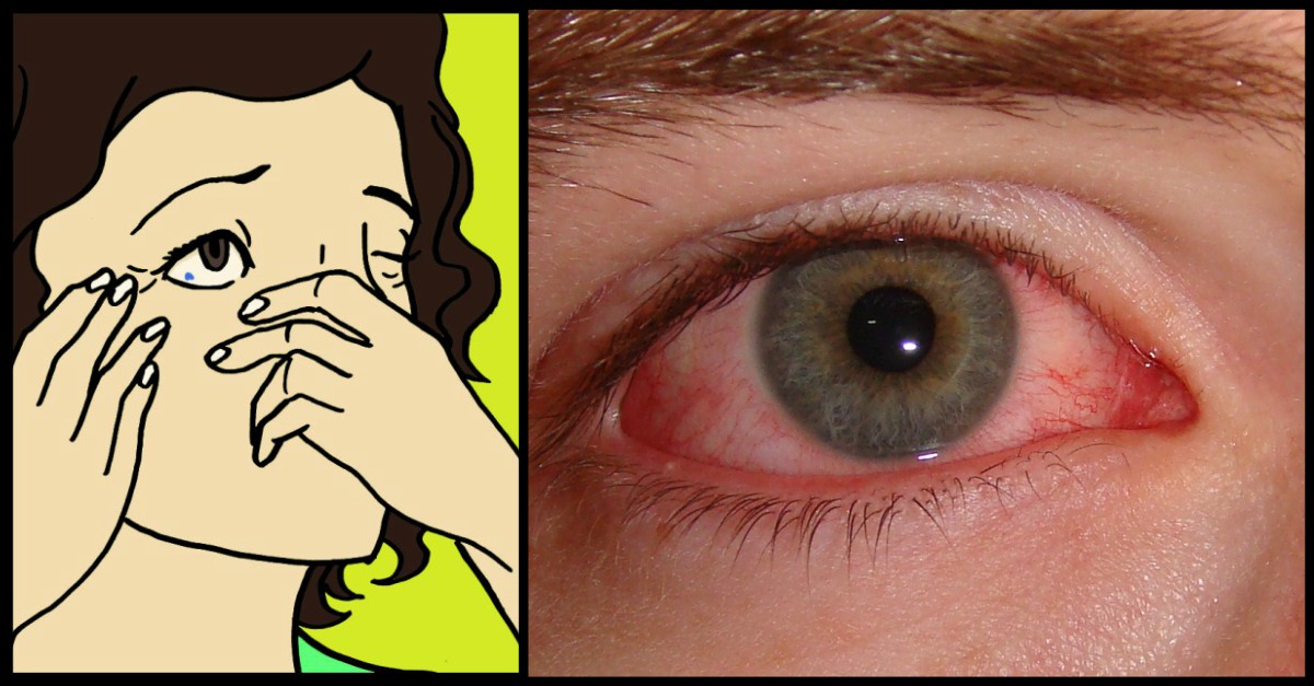 10 Alarming Health Red Flags From Your Eyes | LittleThings.com