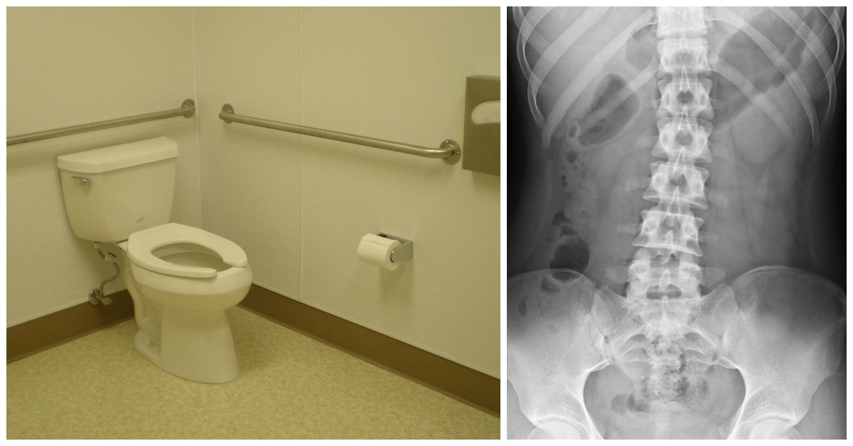 8 Irritable Bowel Syndrome Symptoms You Should Know About ...