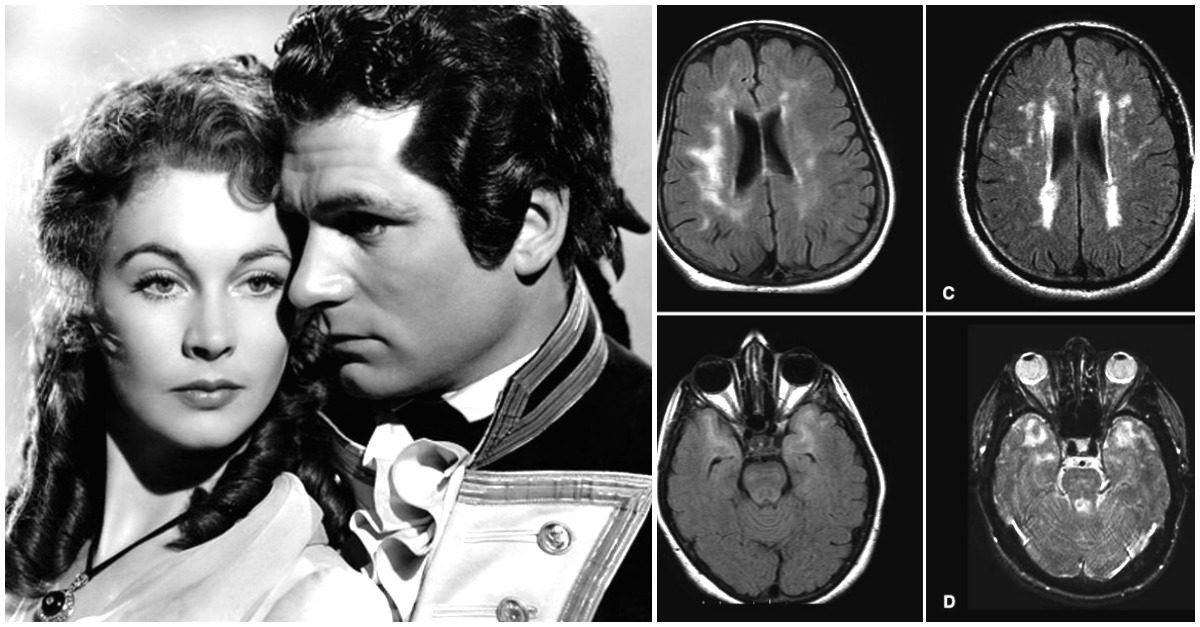 Tragic Couples In Hollywood: 9 Heartbreaks You Never Heard ...