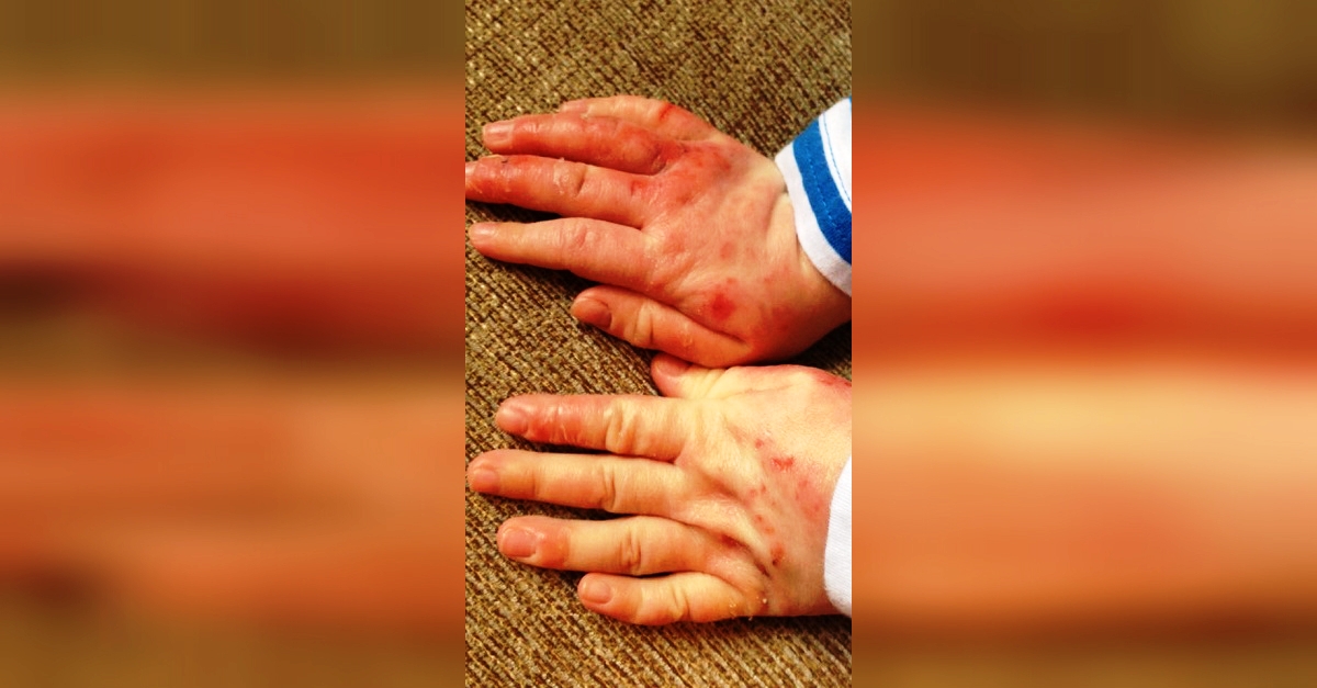 Mom Takes A Photo Of Her Baby's Red Hands. When The Doctor Says THIS ...
