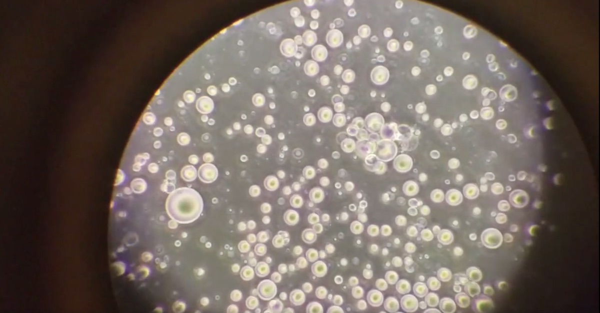Mom Puts One Drop Of Breast Milk Under Microscope, Then Catches Strange ...