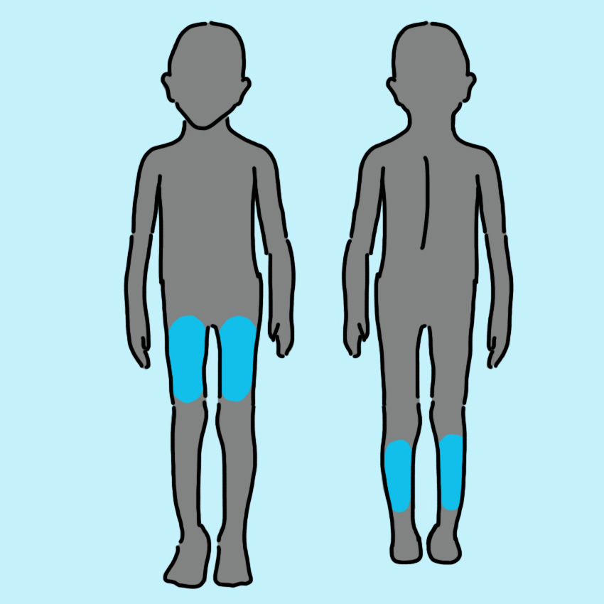 Sitting In A 'W' Position Can Negatively Affect Health | LittleThings.com