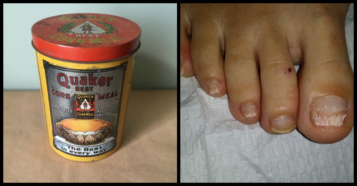 9 Cheap, Easy Home Remedies to Clear Up Yucky Toenail Fungus ...