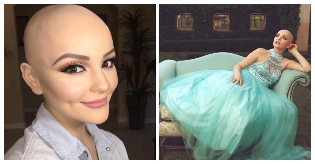 Lovely 17-Year-Old Proves Cancer Can't Dim Her Beautiful Spirit ...