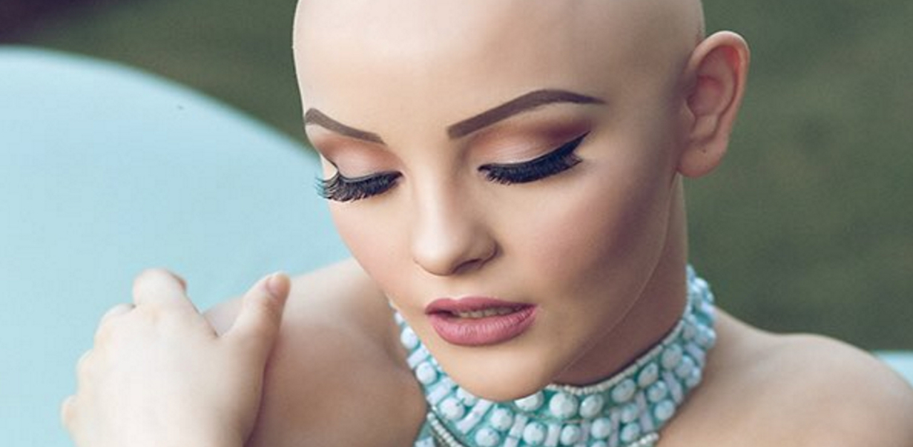 Lovely 17-Year-Old Proves Cancer Can't Dim Her Beautiful Spirit ...