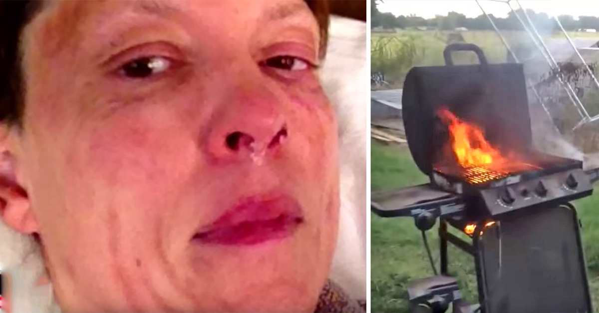 Grill Burst Into Flames In Mom's Face. Then Firefighters Realize ...