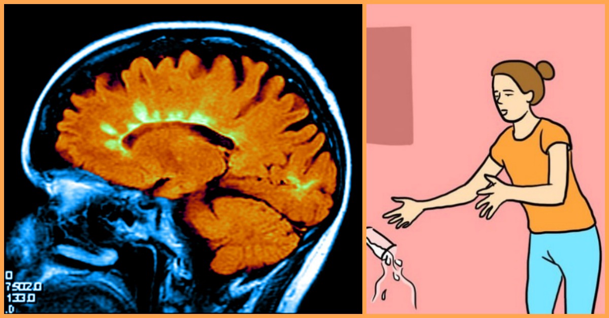 10 Early Warning Signs Of Multiple Sclerosis To Look Out For ...