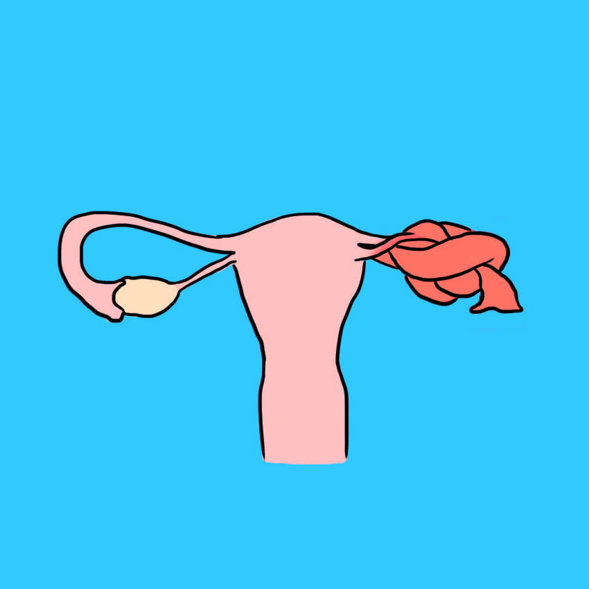 Twisted Ovaries: 8 Red Flag Symptoms Women Should Never, Ever Ignore ...