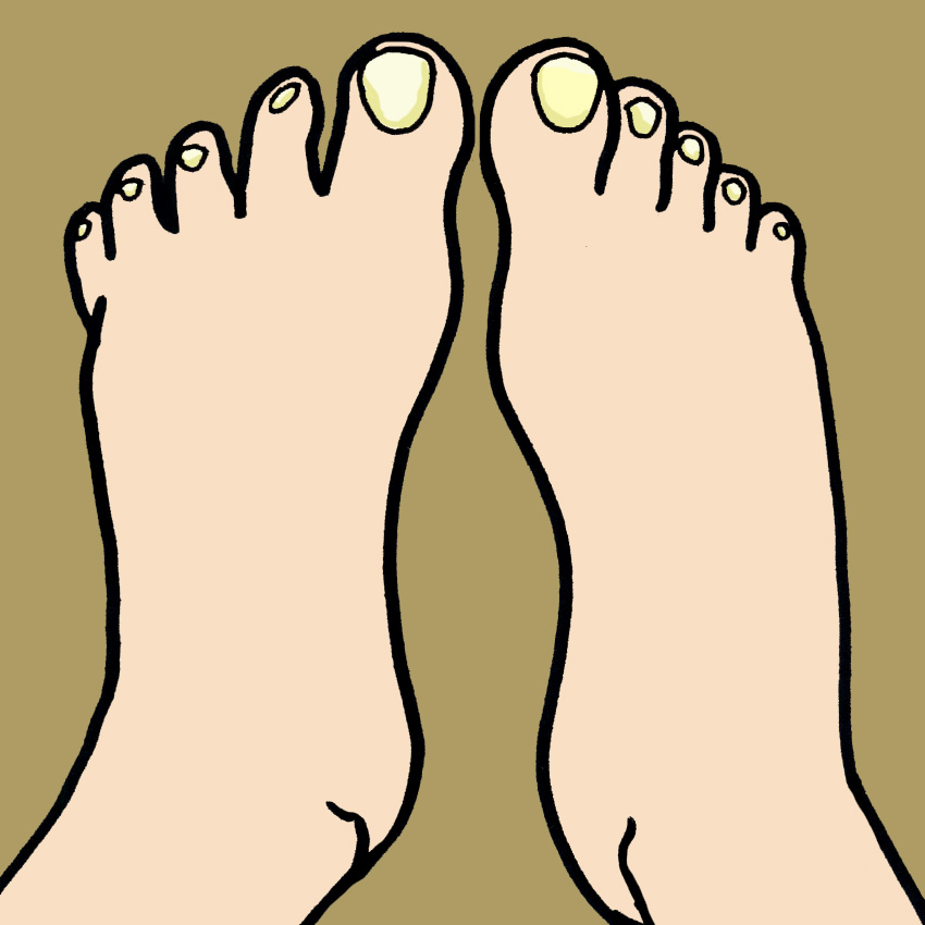 Candida Overgrowth Symptoms: 6 Signs Of Having Too Much Yeast ...