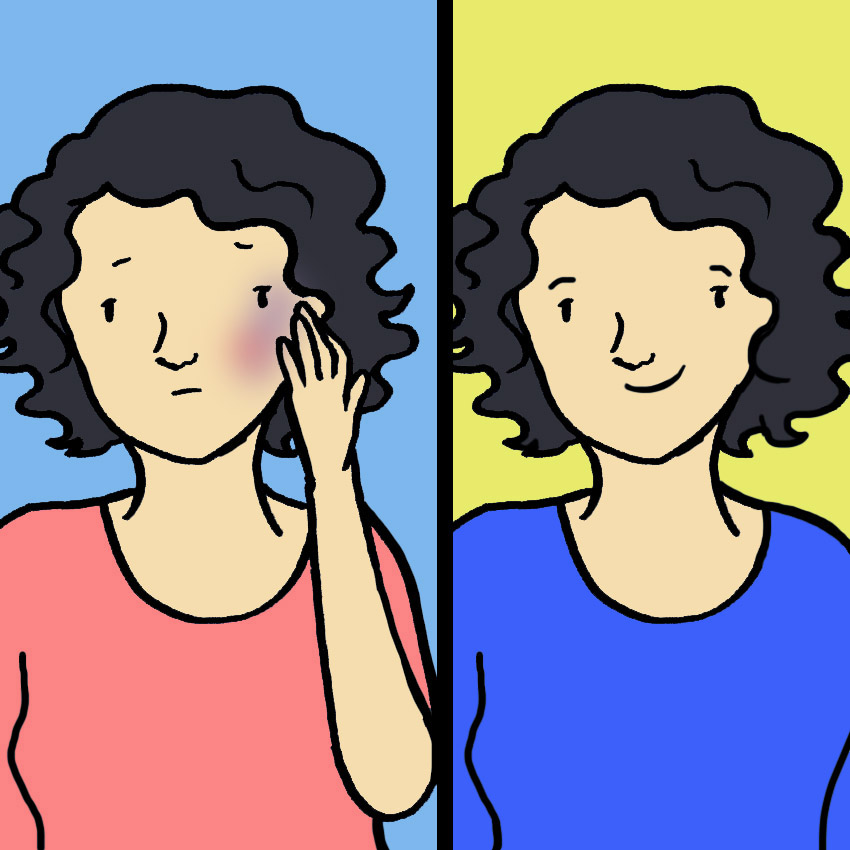 How To Get Rid Of Bruises Fast Using Home Remedies | LittleThings.com