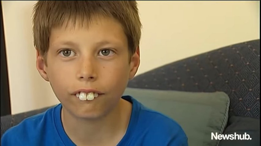 Strangers Help Bullied Boy With Giant Buck Teeth Get New Smile