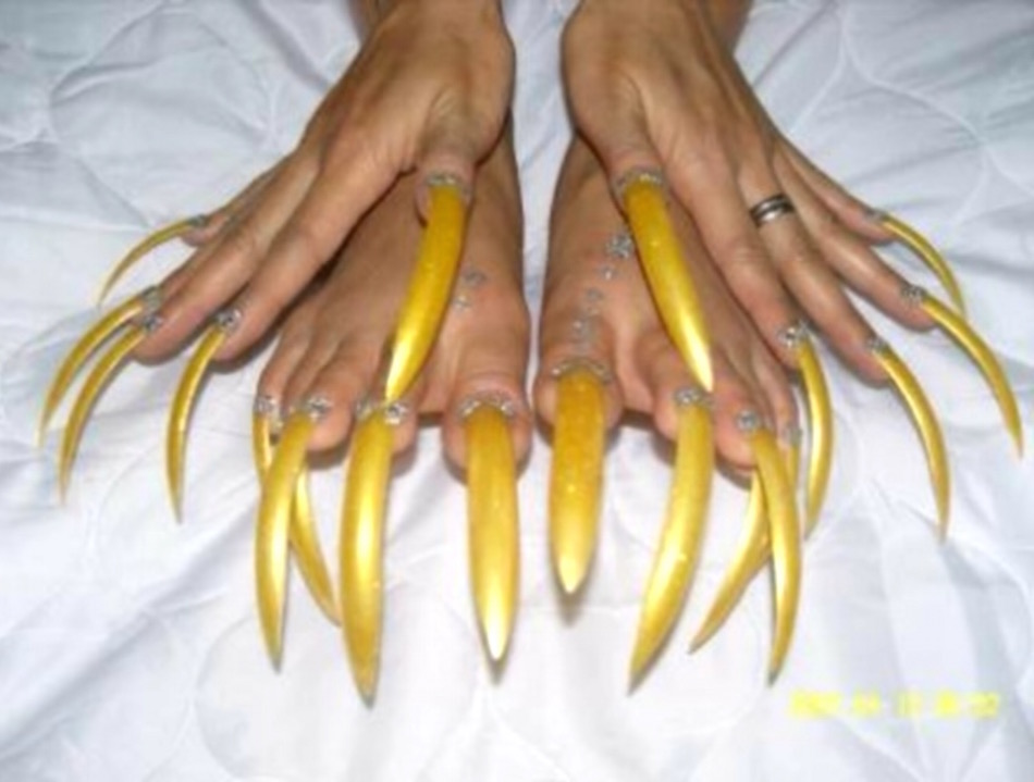 These Extra Long Toenails Are Quite the Sight To See | LittleThings.com