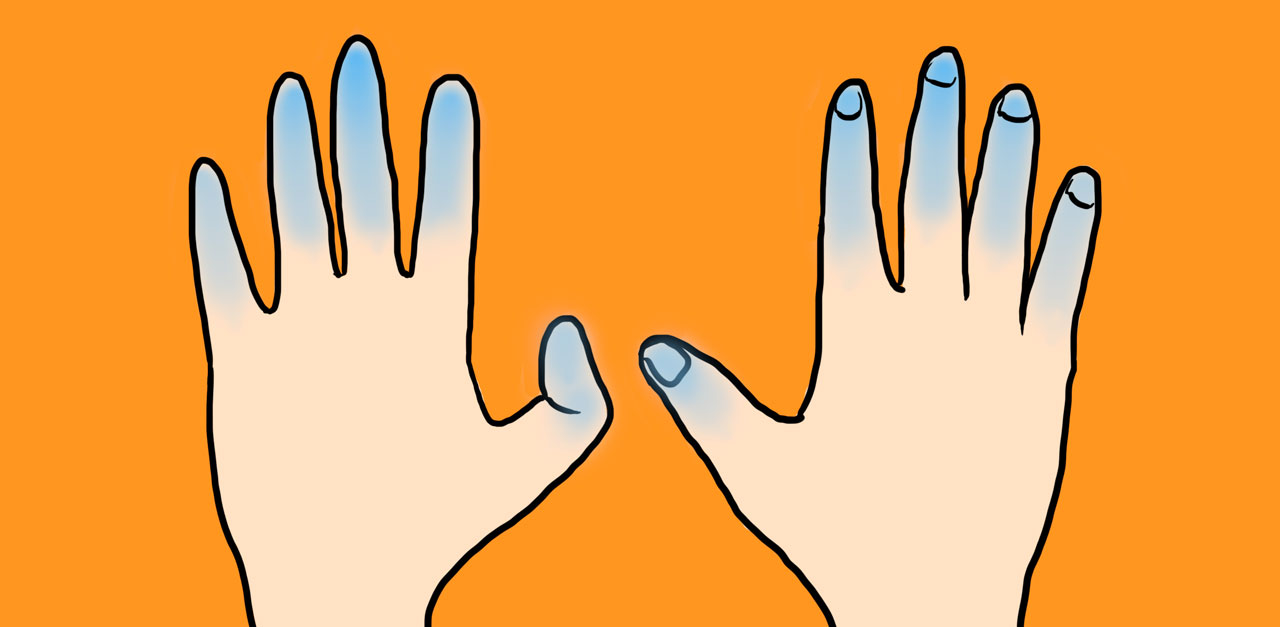 8 Early Warning Signs Of Lupus Everyone Should Know | LittleThings.com