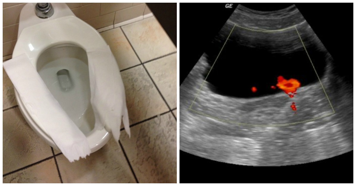 Shy Bladder: How To Deal With An Inability To Pee In Public ...