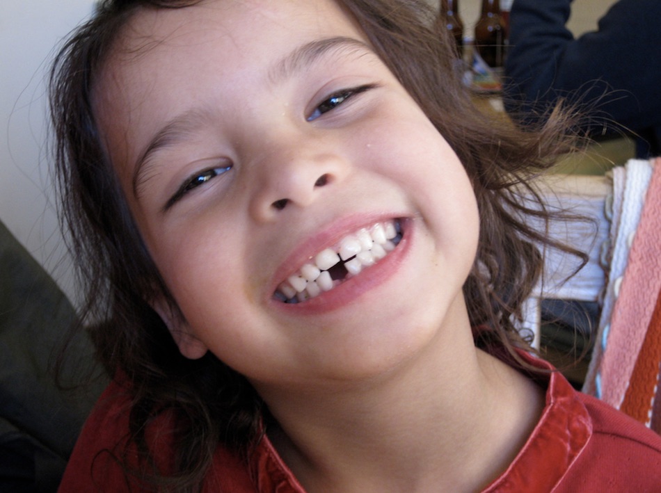 Doctors Are Urging Parents To Keep Their Kids' Baby Teeth ...