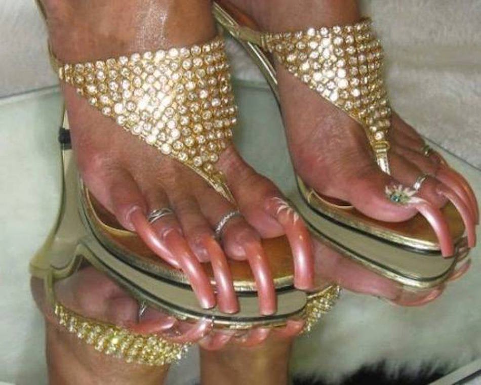 These Extra Long Toenails Are Quite the Sight To See | LittleThings.com