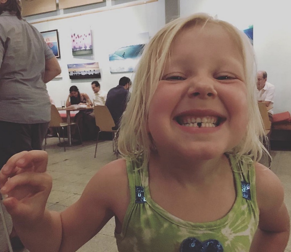 Doctors Are Urging Parents To Keep Their Kids' Baby Teeth ...