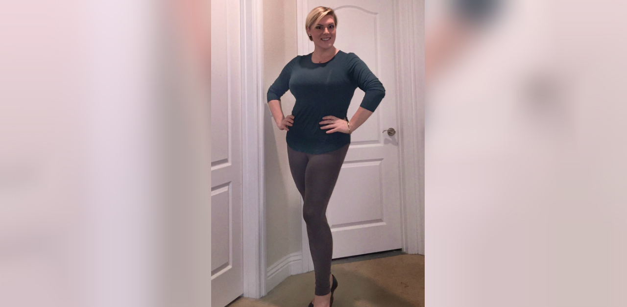 Daughter Gets Skin-Removal Surgery After Losing 130 Pounds ...