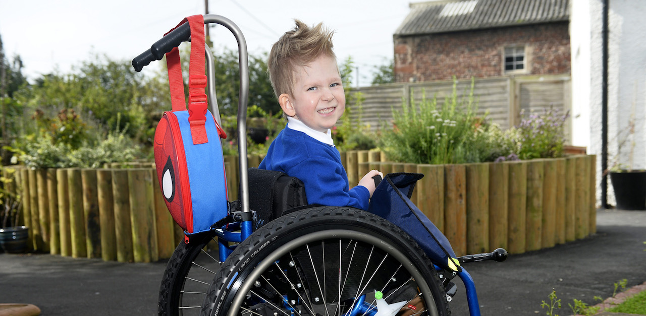 Baby With No Brain Has Miraculous Recovery | LittleThings.com