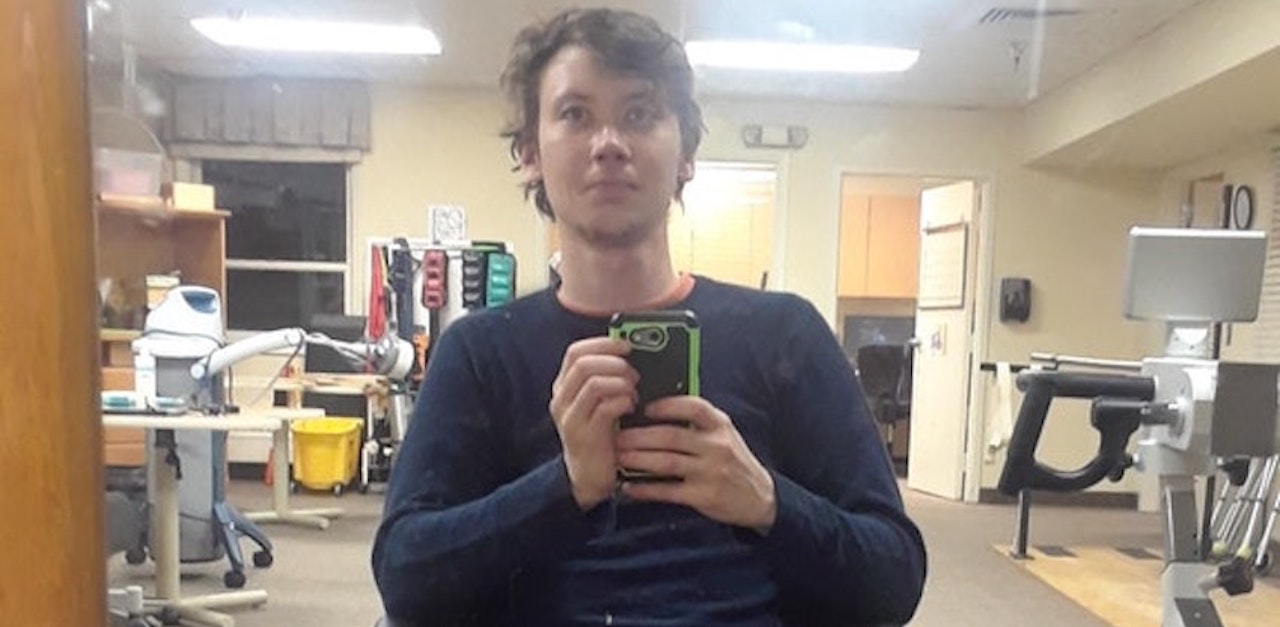 Man Shares Picture 1 Month After Amputation Due To Severe Frostbite ...