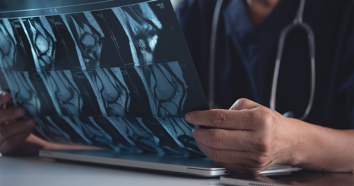 X-linked hypophosphatemia