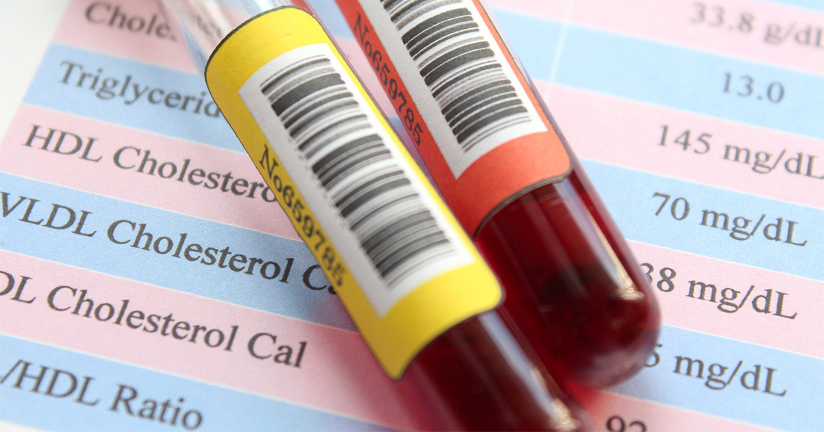 What Is Cholesterol?