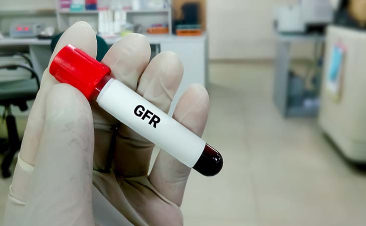 What is eGFR?