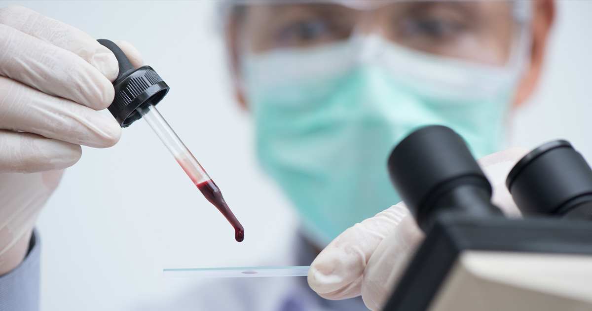 What is the Ham test for PNH?