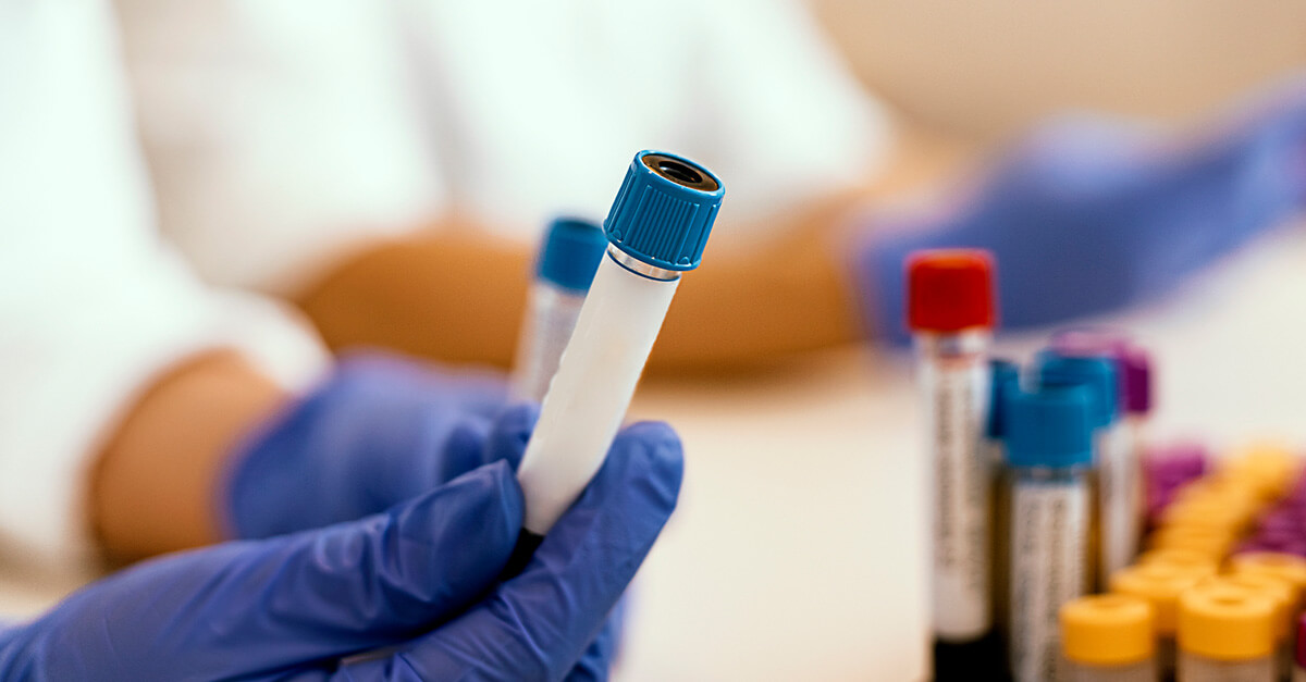 CML and AML: What’s the difference?