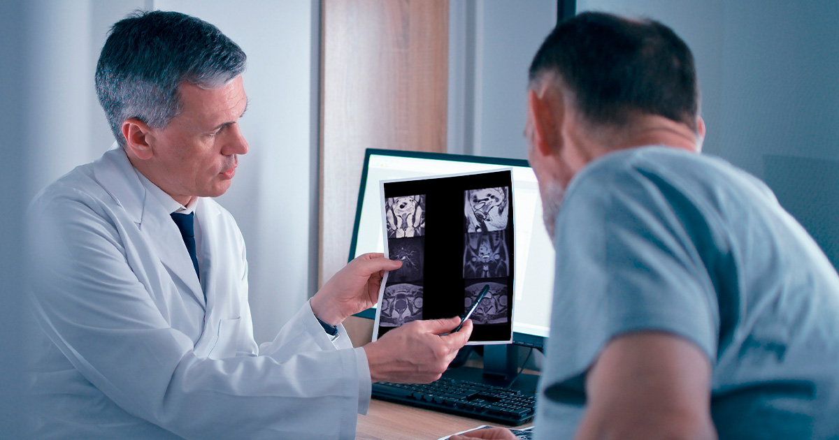 Types of rare prostate cancer