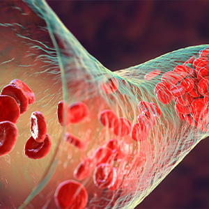 What is the Ham test for PNH?