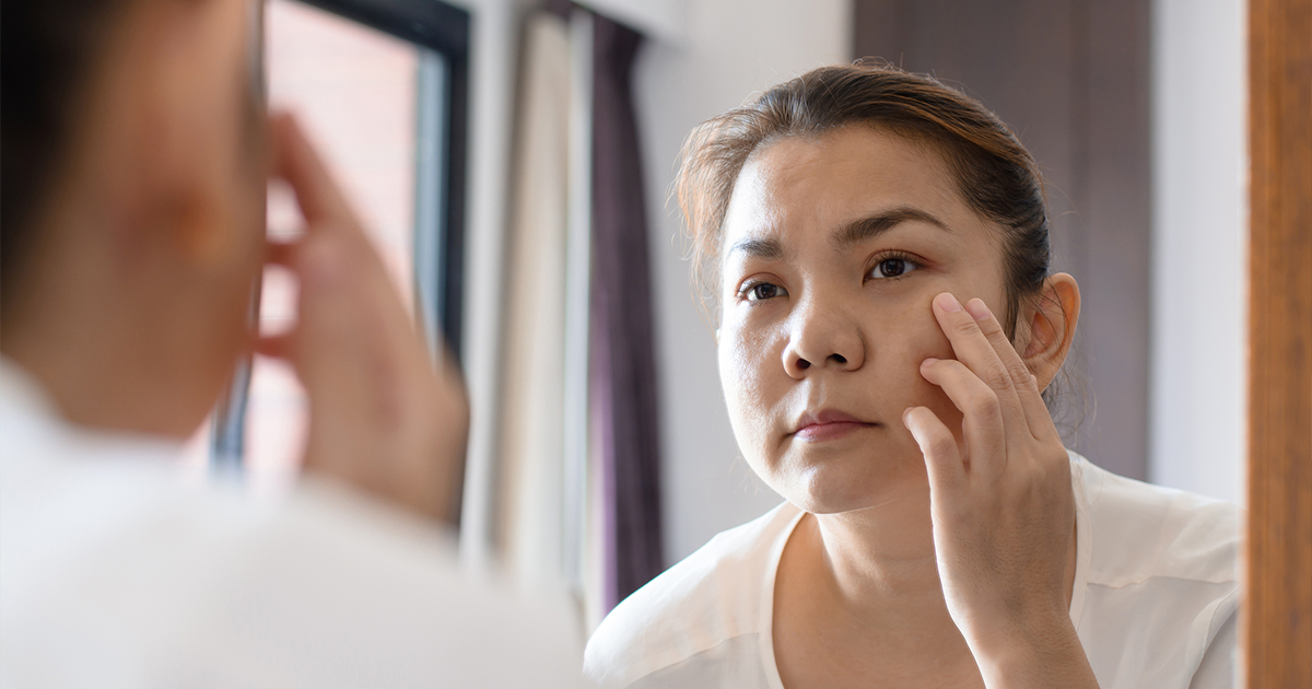 Can PBC cause skin problems? Understanding the skin-liver connection