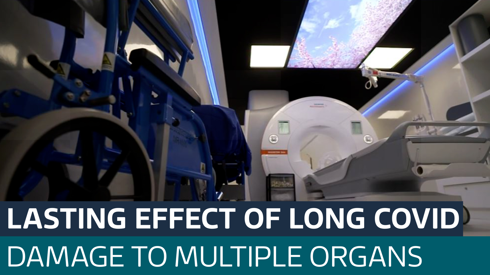 Patients with long Covid three times more likely to have damage to ...