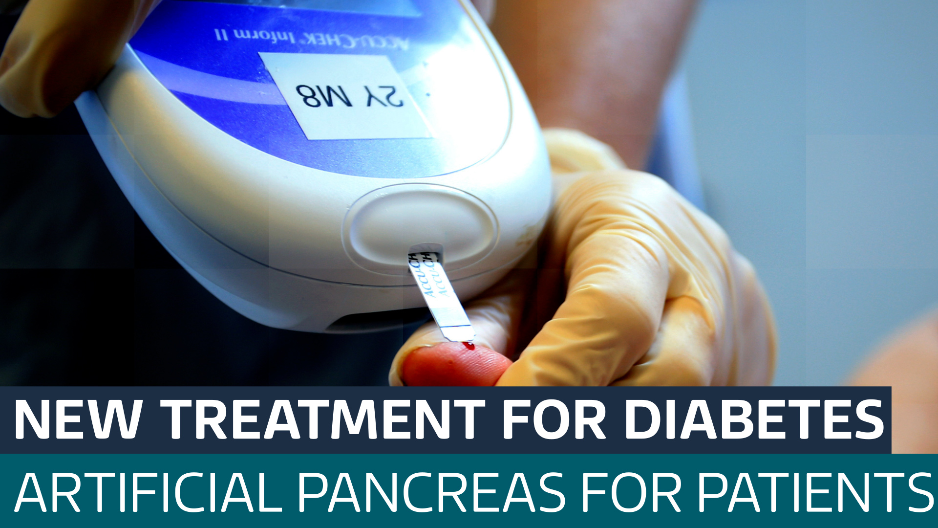 New treatment for type 1 diabetes as patients offered artificial ...