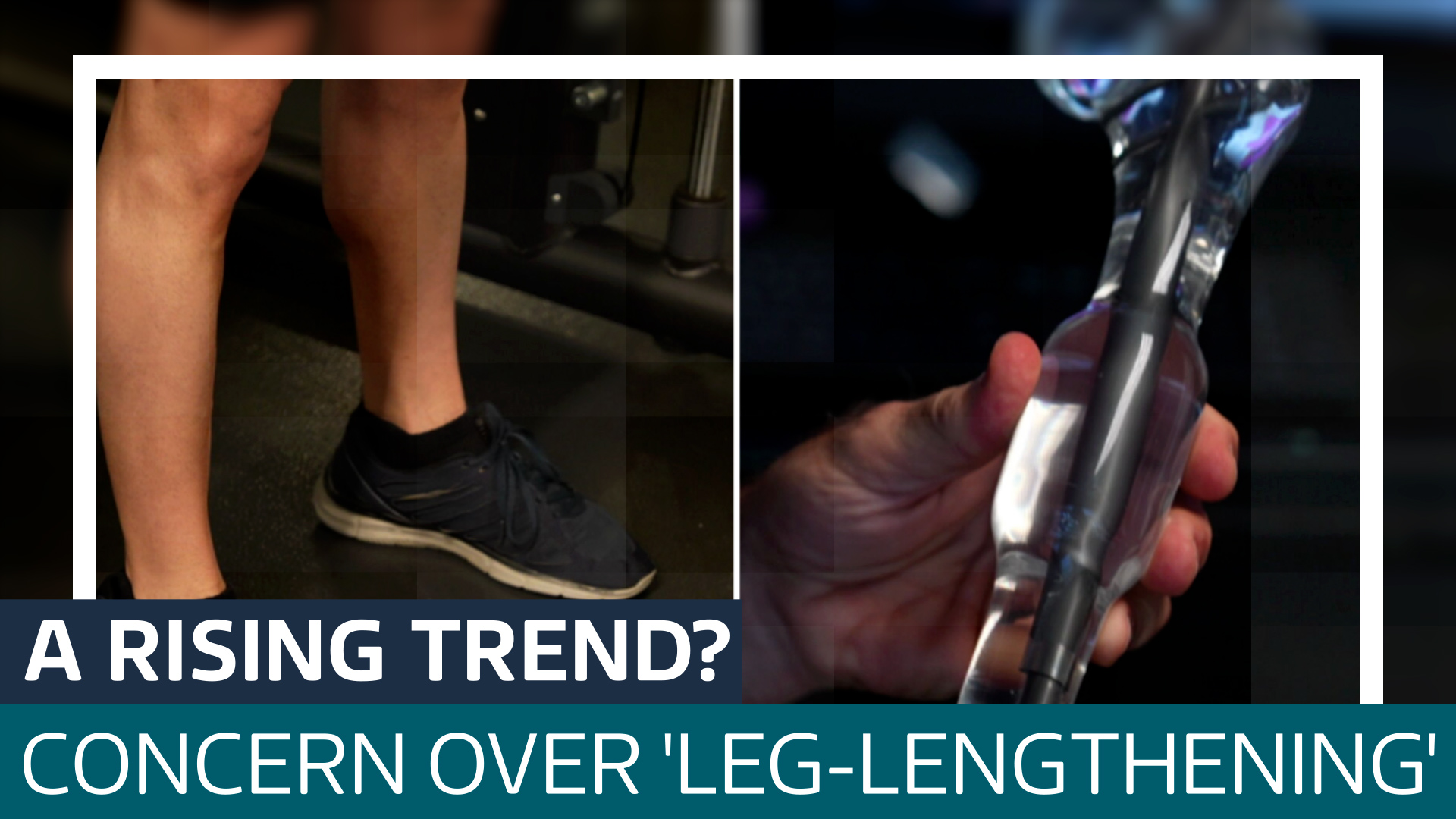 'Voluntarily breaking your legs': Rise in controversial leg-lengthening ...