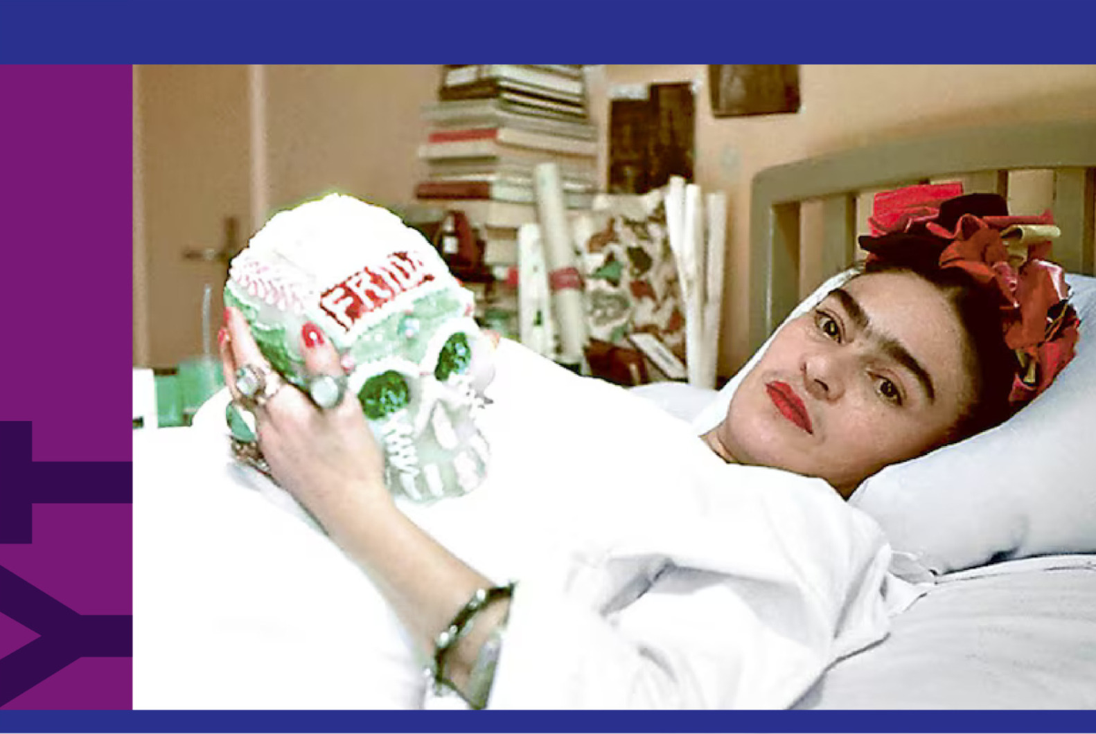 Frida Kahlo y el síndrome de la cola de caballo: Un diagnóstico 70 años ...