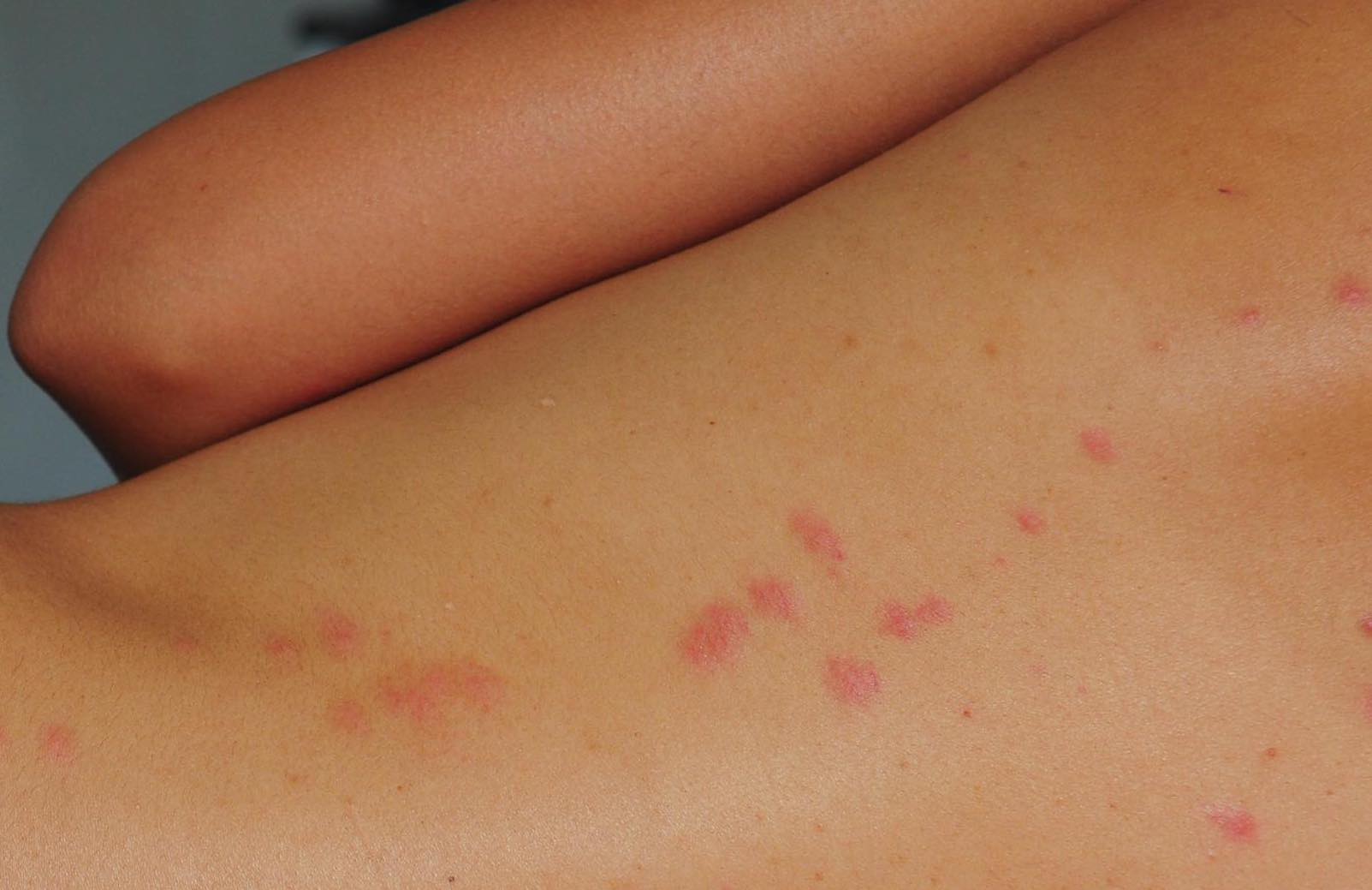 Bettwanzen bekämpfen: Unser Anti-Schädlingsguide